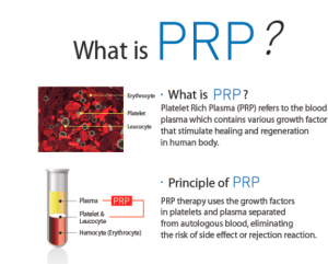 Vampire Facials and Platelet Rich Plasma (PRP) - Dr Rachel Ho