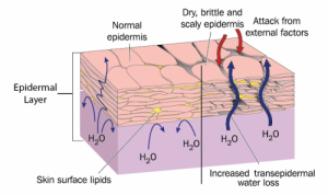 Ceramides in Skin: Protect Against Sensitive & Dry Skin, Eczema and ...