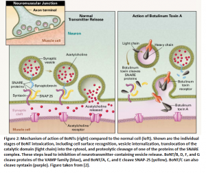 Botulinum toxin vs Fillers: Differences, Uses, Effects and ...