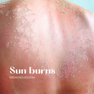 How Extreme Heat and Humidity Affect Your Skin - Dr Rachel Ho