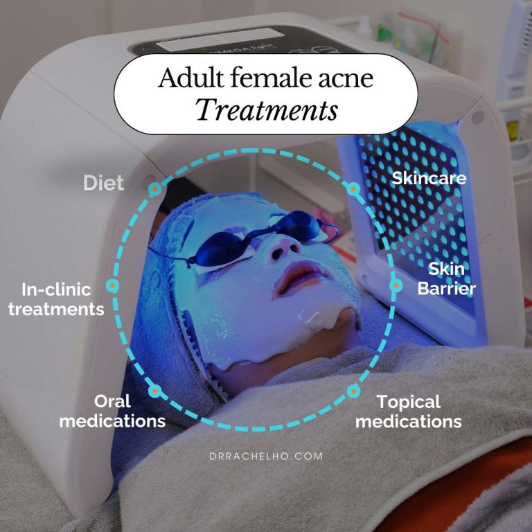 Adult Female Acne: A Doctor Explains (Singapore) - Dr Rachel Ho